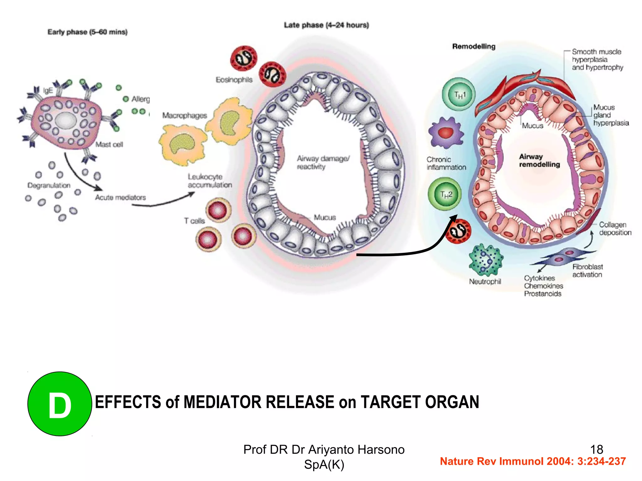 Allergy march from atopic dermatitis to lifelong allergy | PPT