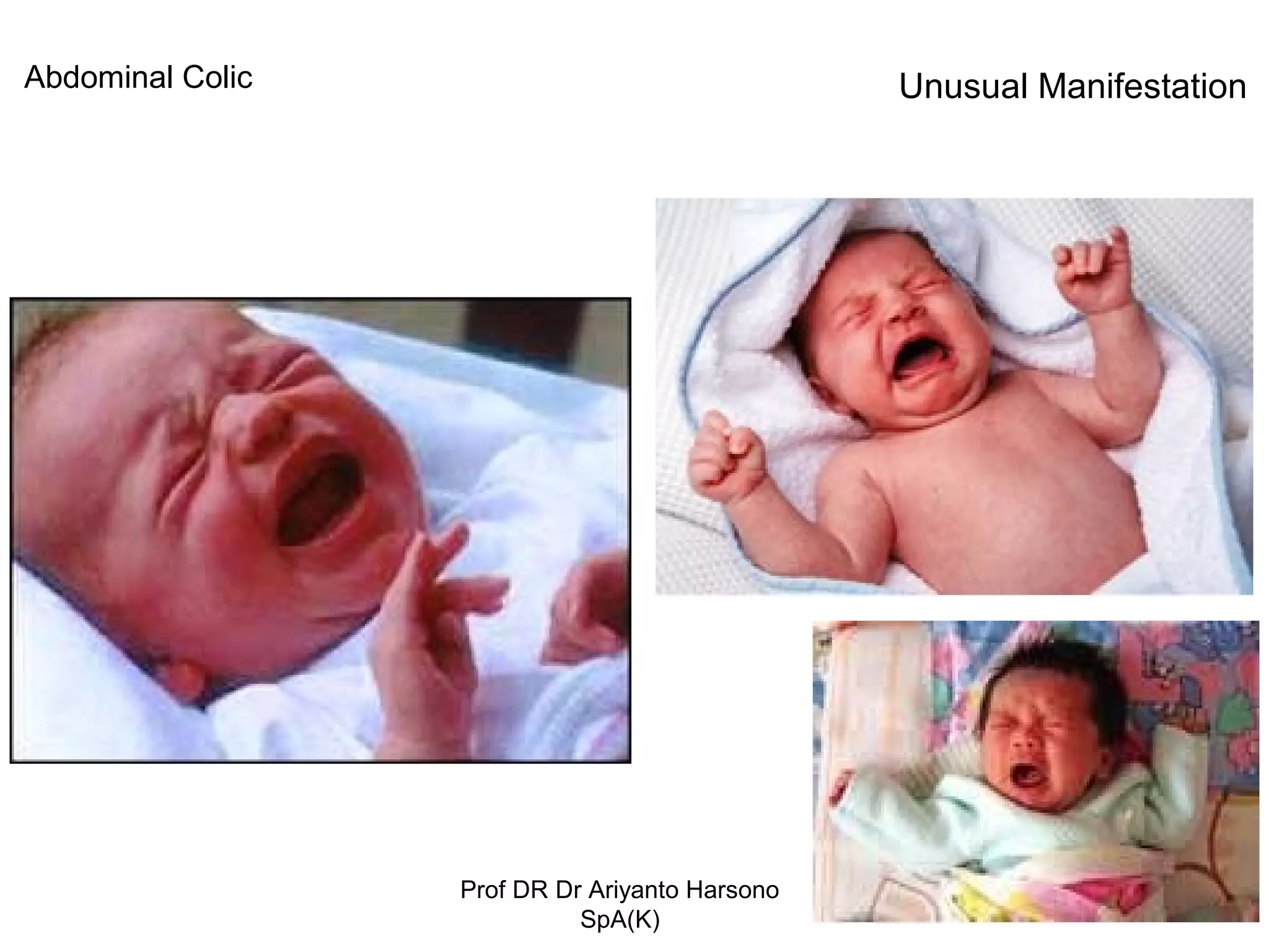 Allergy march from atopic dermatitis to lifelong allergy | PPT