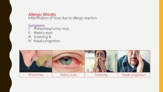Allergy, Allergen & Antibody | PPTX