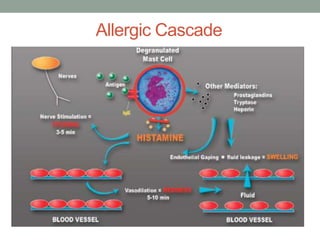 Allergy Review By Dr. Allen | PPT