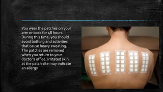 Allergy skin test | PPTX
