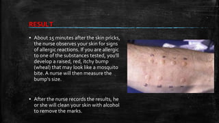 Allergy skin test | PPTX