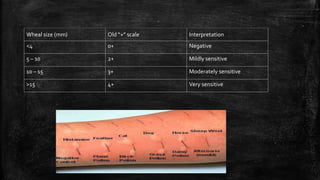 Allergy skin test | PPTX