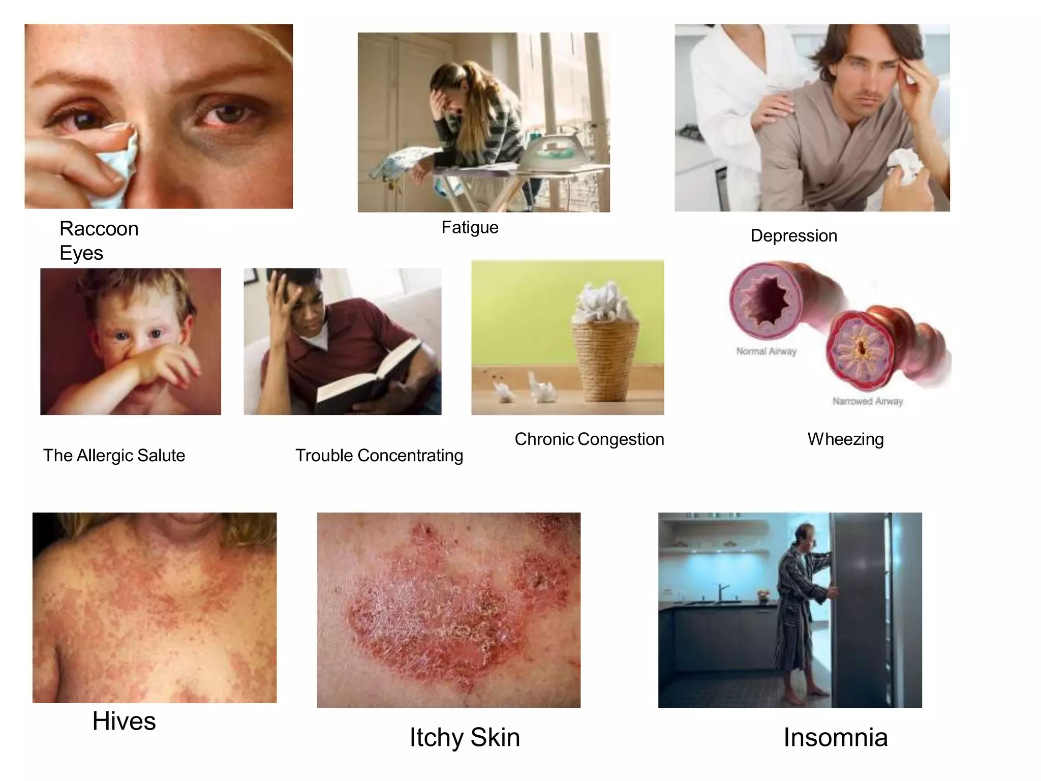 allergy tests.pptx