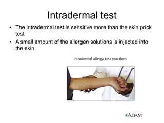 allergy tests.pptx