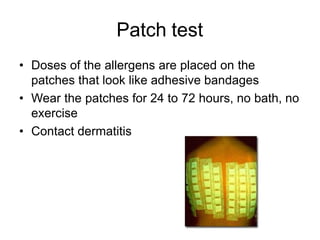 allergy tests.pptx