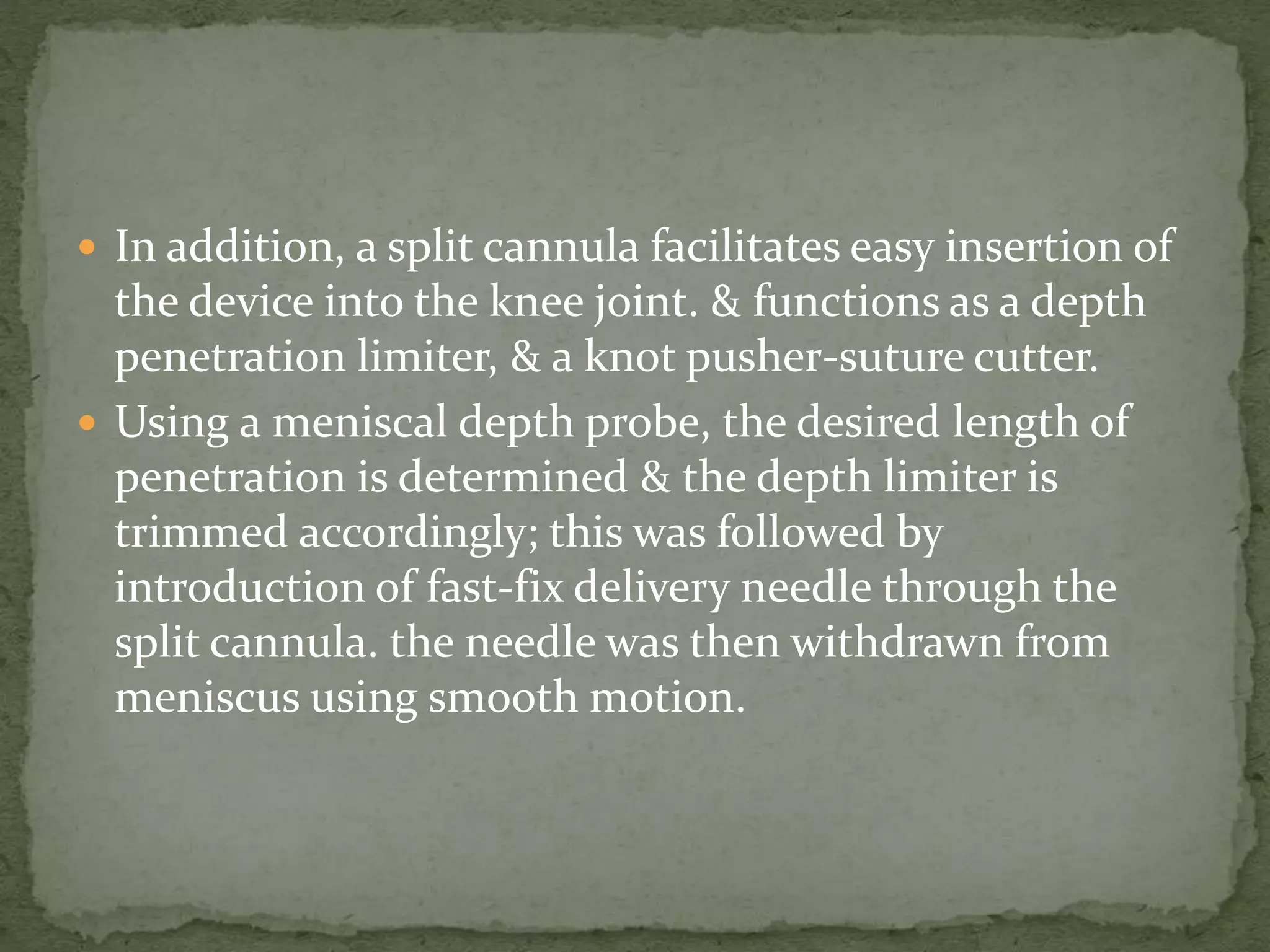Meniscus repair : basics & surgery | PPTX