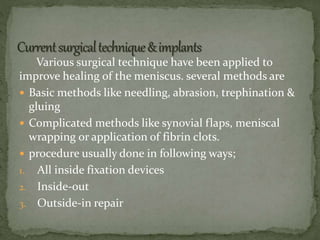 Meniscus repair : basics & surgery | PPTX
