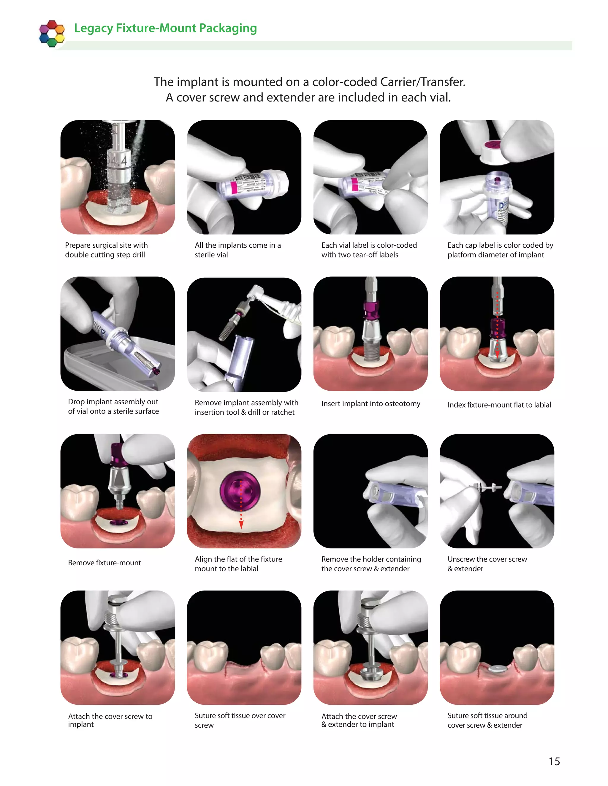 Dentrealmarket All legacy system implant catalog | PDF