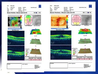 RETINAL CASES-AJAY DUDANI | PPTX