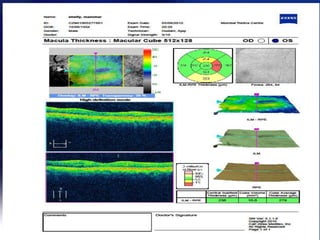 RETINAL CASES-AJAY DUDANI | PPTX