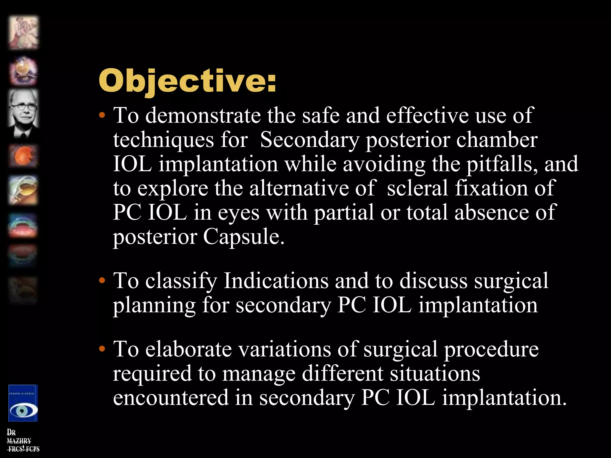 Instruction course-Secondary posterior chamber IOL (PC IOL ...