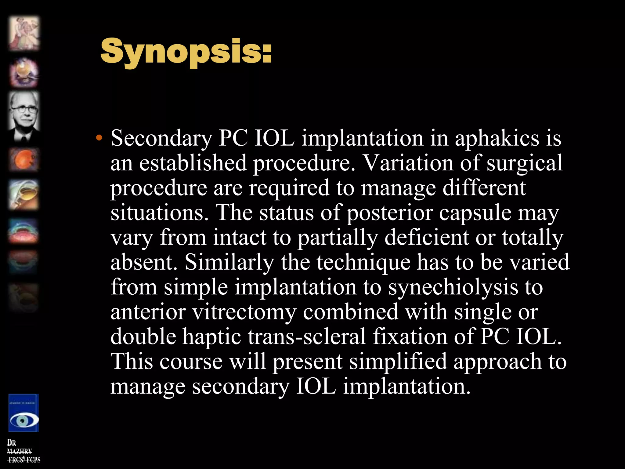 Instruction course-Secondary posterior chamber IOL (PC IOL ...