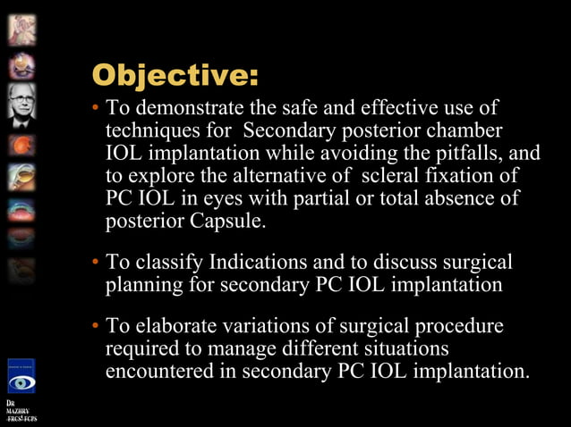 Instruction course-Secondary posterior chamber IOL (PC IOL ...