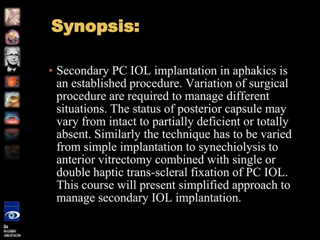 Instruction course-Secondary posterior chamber IOL (PC IOL ...