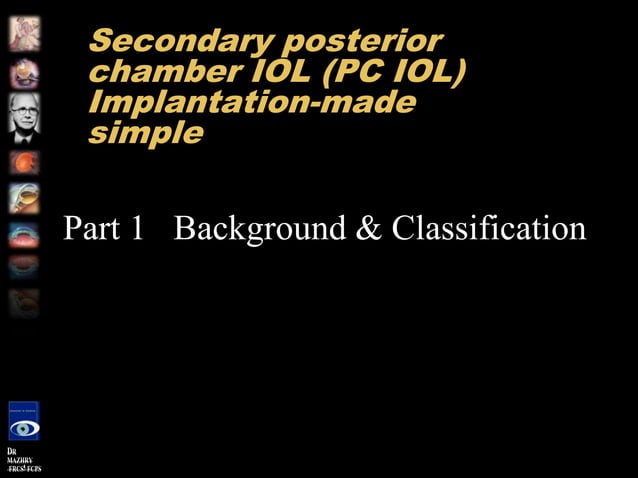 Instruction course-Secondary posterior chamber IOL (PC IOL ...