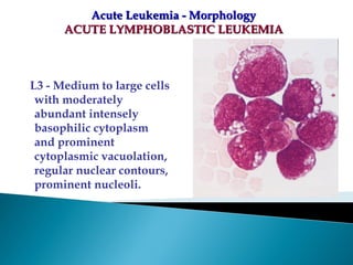 ALL_Naseem. Acute Lymphoblastic leukemia presentation PPTpdf | PDF
