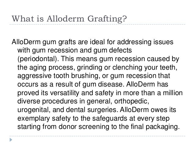 Alloderm grafting Miami - Dr. Tal Morr