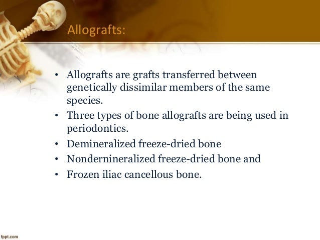 Allograft