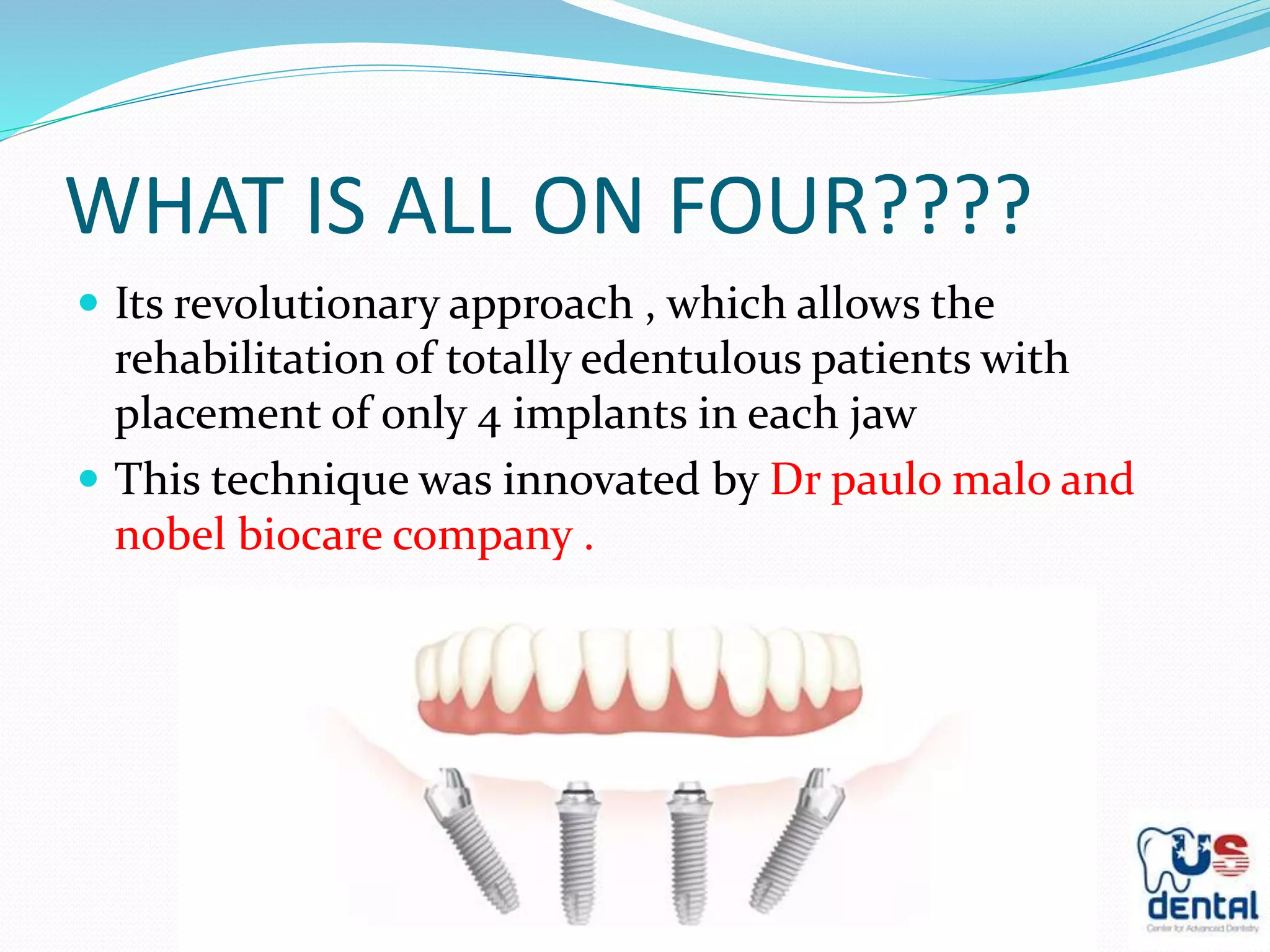 All On Four Dental Implant System | PPTX
