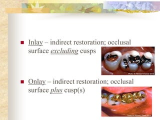 Alloys for inlays | PPTX