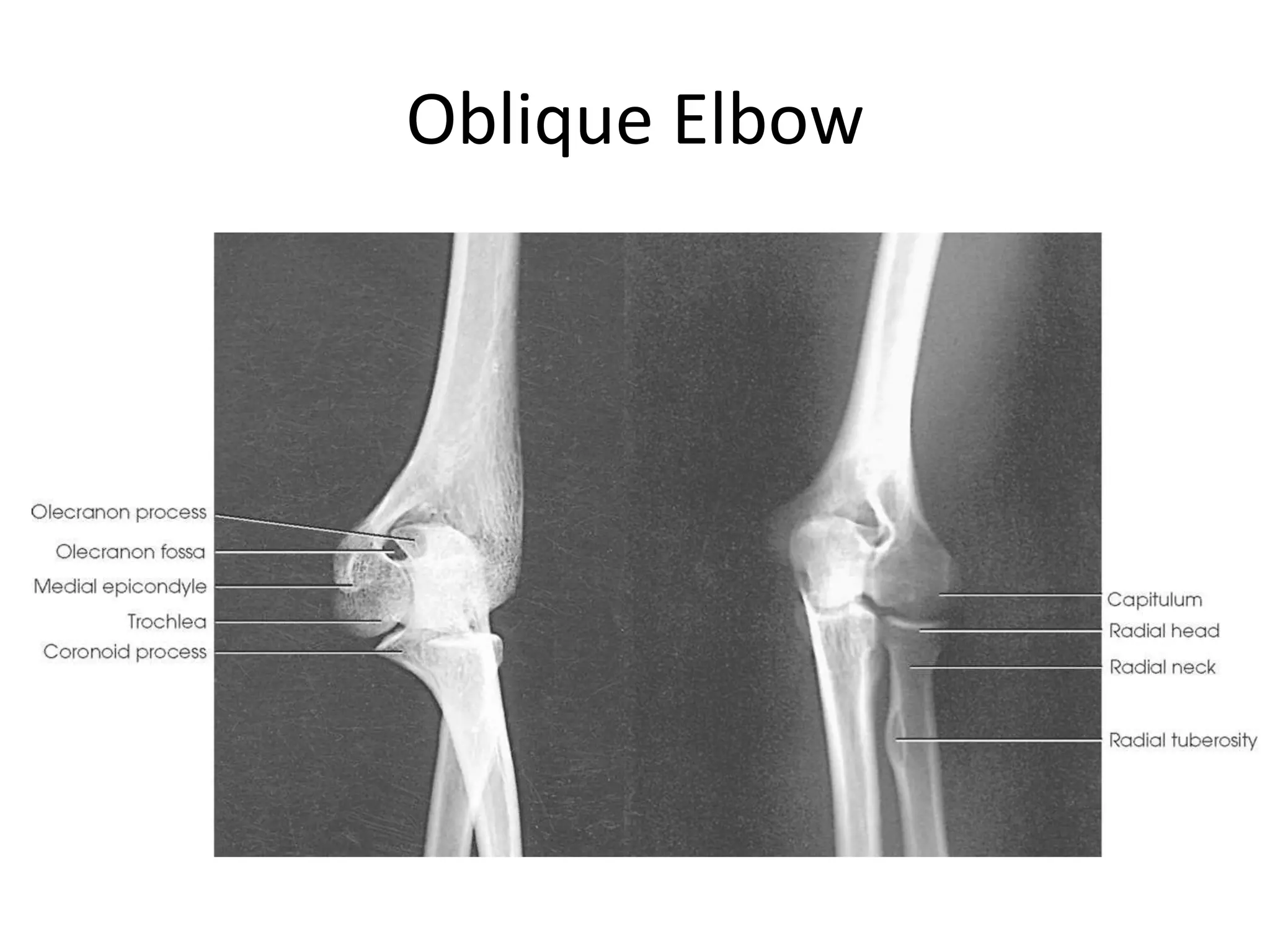 All projections Anatomy | PPTX