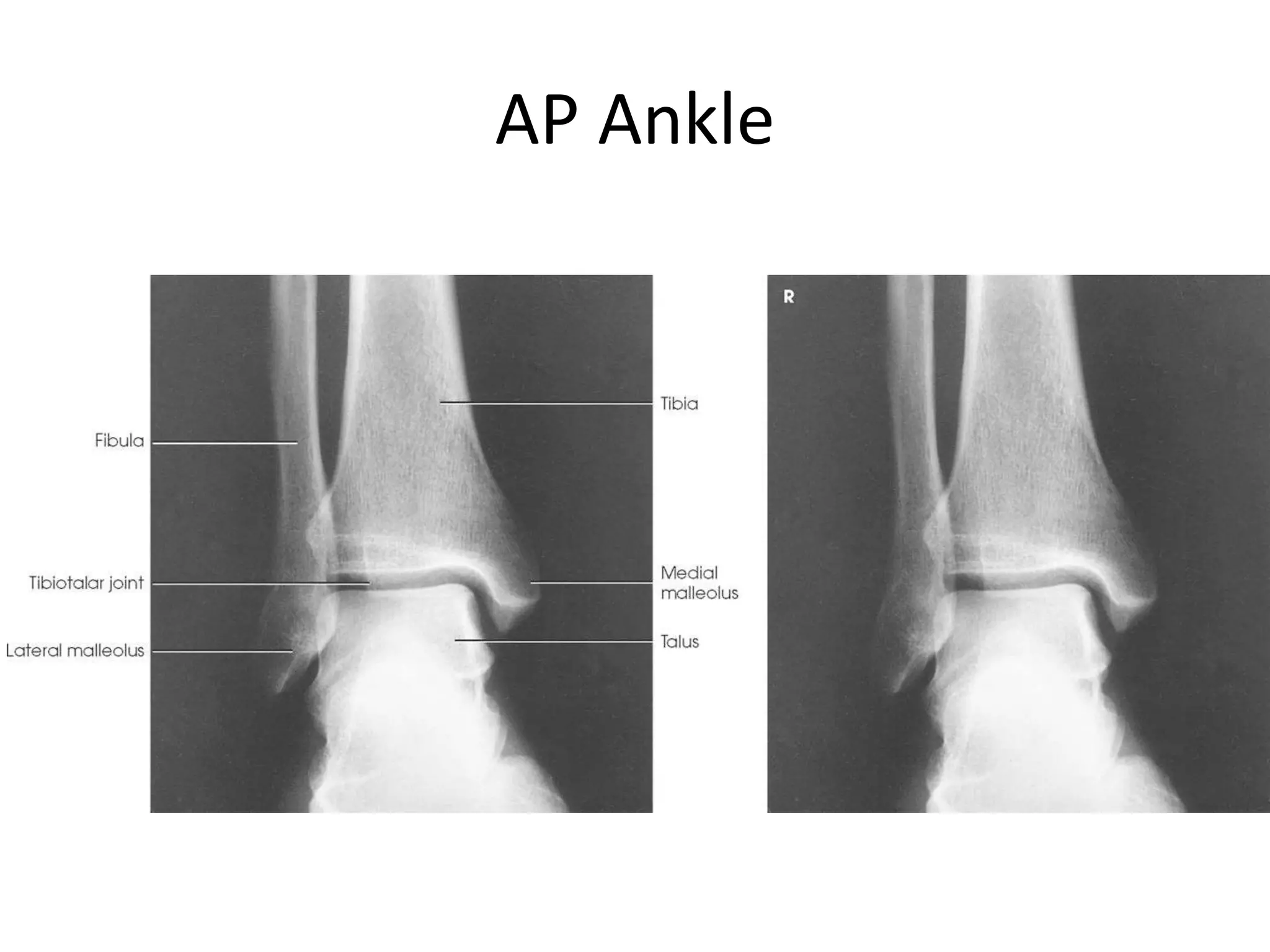 All projections Anatomy | PPTX