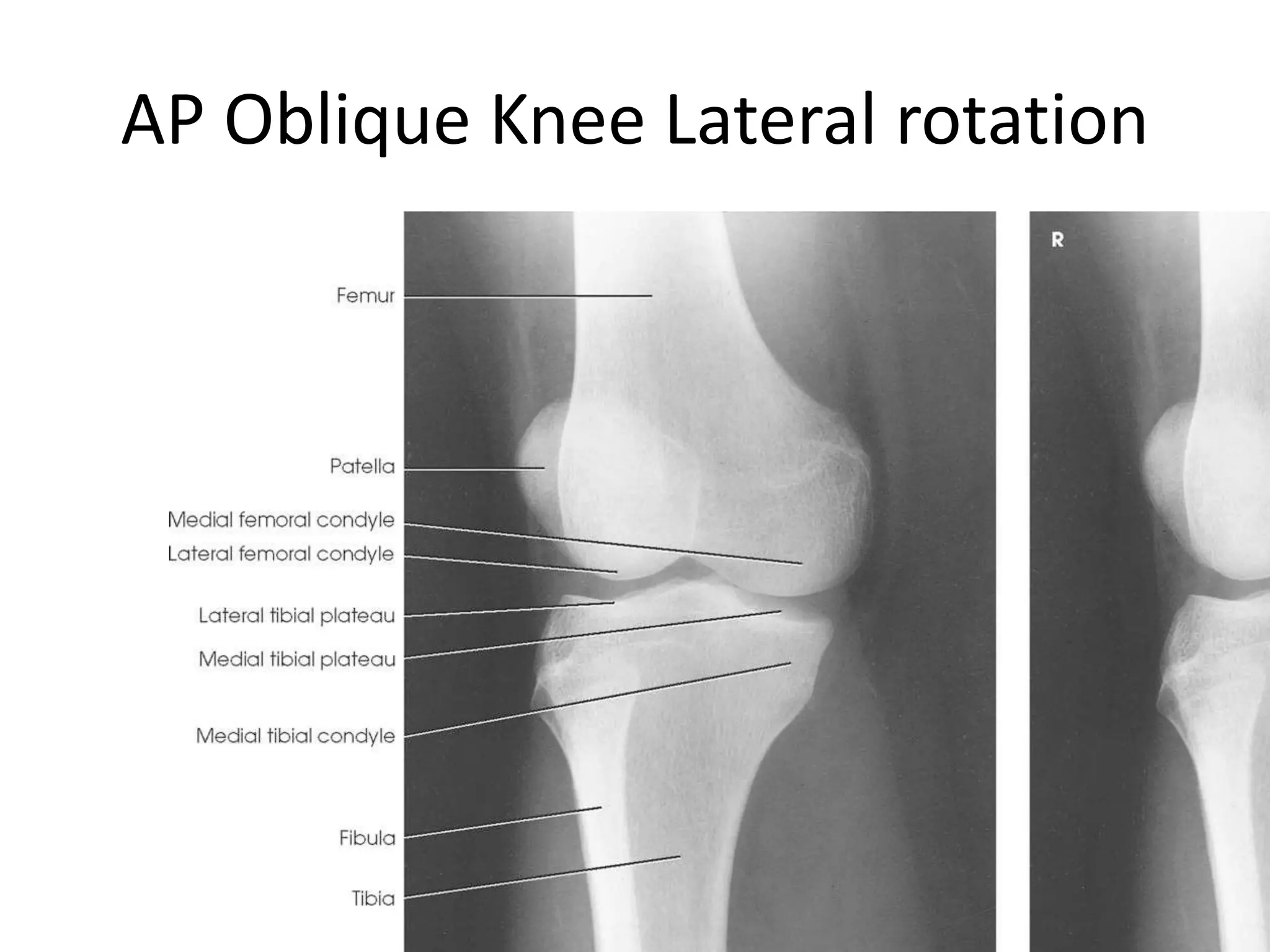 All projections Anatomy | PPTX