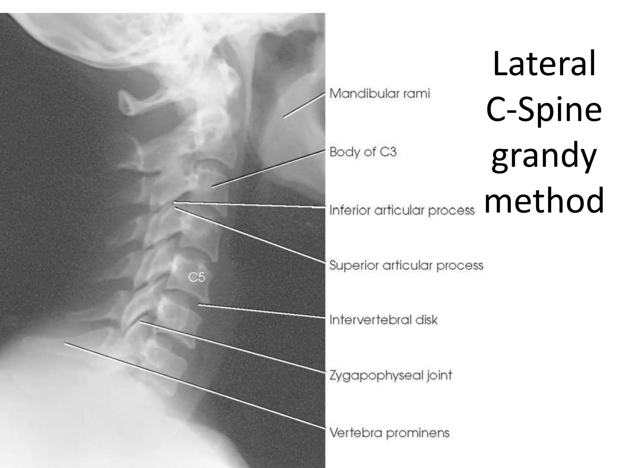 All projections Anatomy | PPTX
