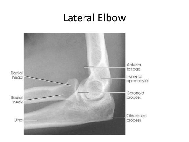 All projections Anatomy