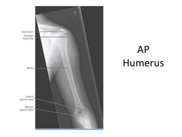 All projections Anatomy