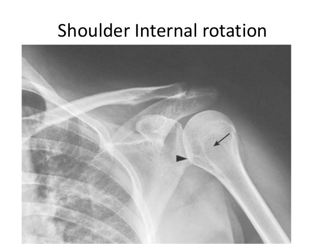 All projections Anatomy