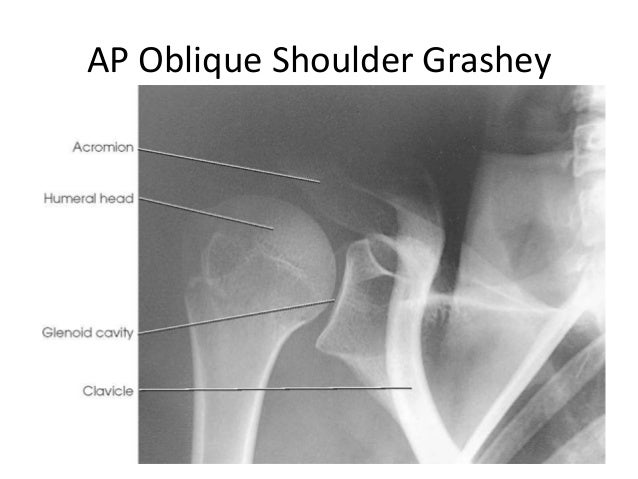 All projections Anatomy