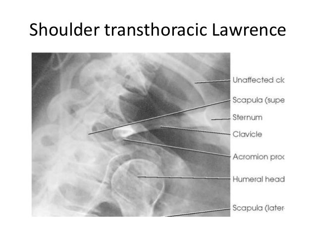 All projections Anatomy