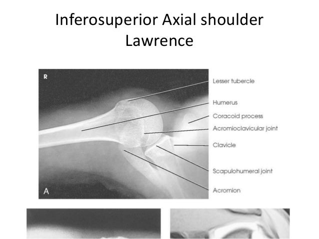 All projections Anatomy