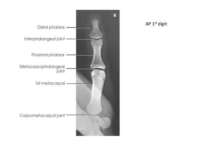 All projections Anatomy