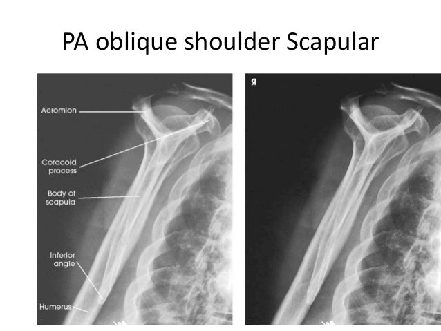 All projections Anatomy