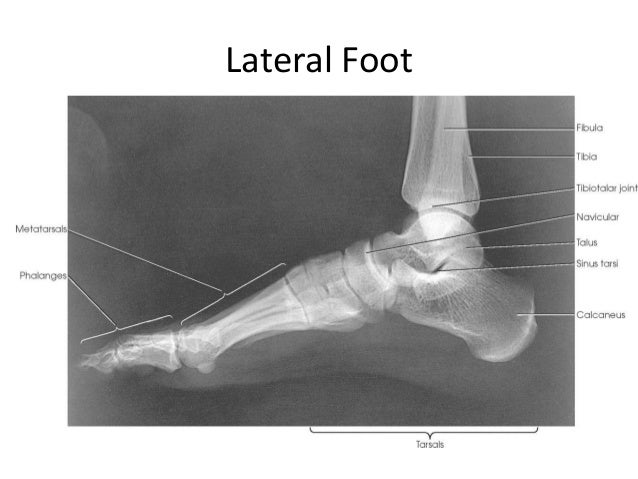 All projections Anatomy