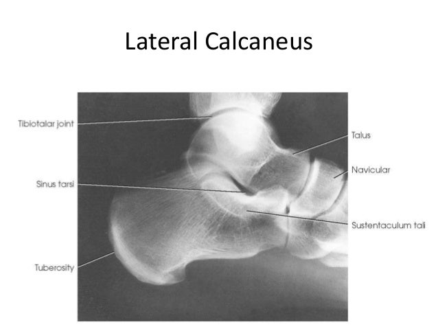 All projections Anatomy