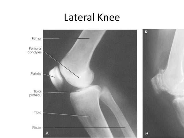 All projections Anatomy