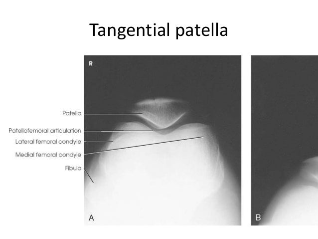 All projections Anatomy