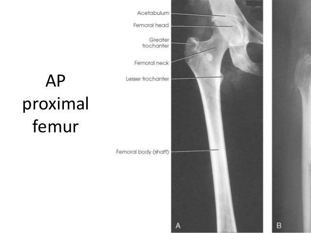 All projections Anatomy
