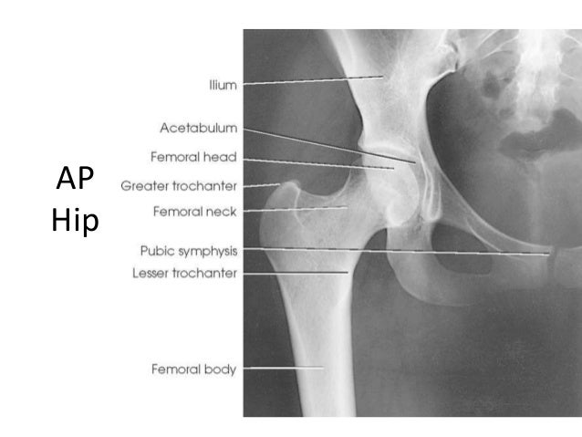 All projections Anatomy