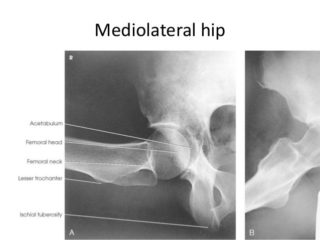 All projections Anatomy