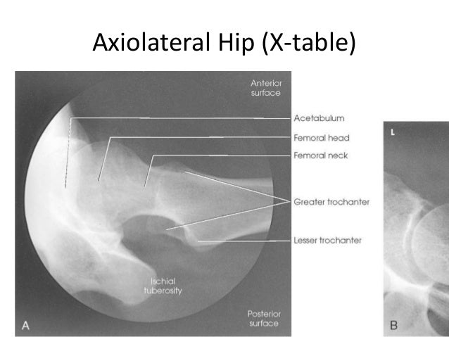 All projections Anatomy
