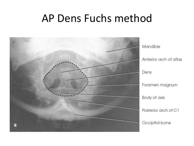 All projections Anatomy