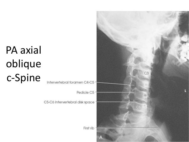 All projections Anatomy