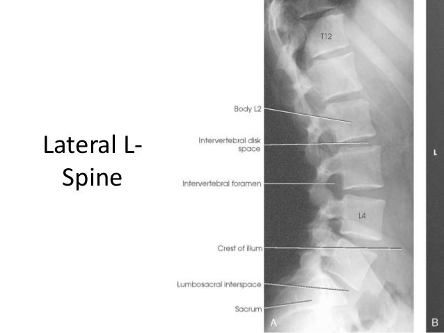 All projections Anatomy