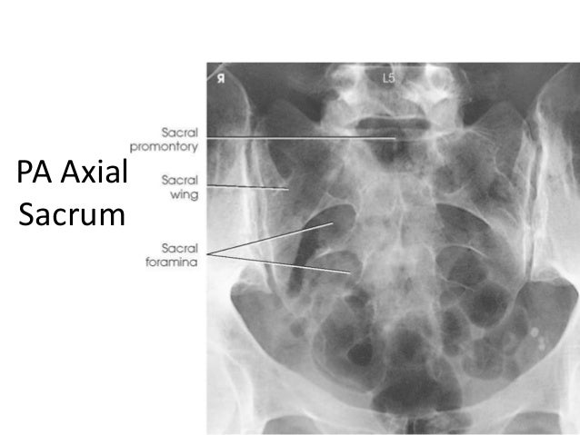 All projections Anatomy