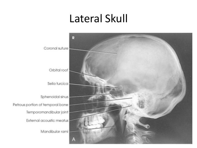 All projections Anatomy